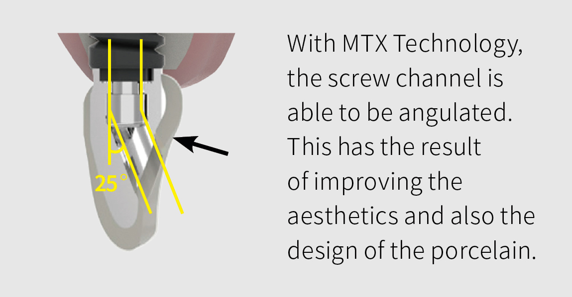 MTX Angulated Screw Channel Bundle